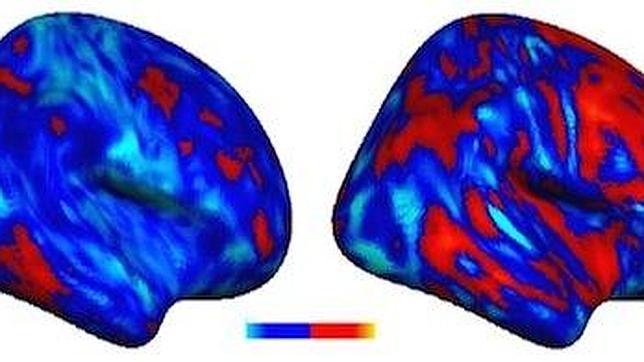 Las señales cerebrales del autismo