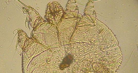 Nuevo brote de sarna en un hospital catalán